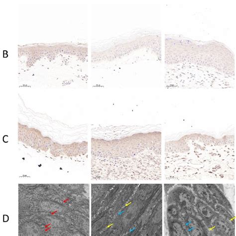 The Expression Of Epidermal Tight Junction Proteins And Observation Of