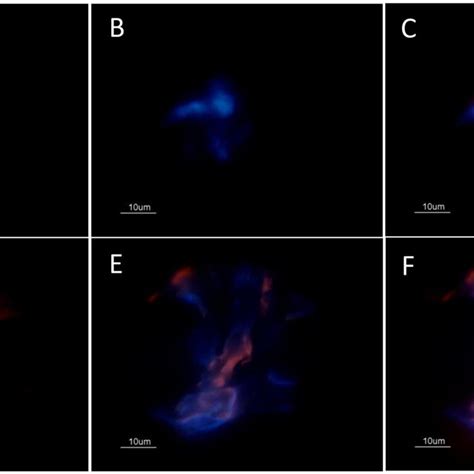 Colocalization Analysis Of Neutrophil Elastase And Dna By Download