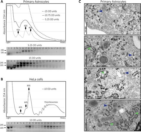 The Challenge Of Polyribosomes Detection In Primary Astrocytes A