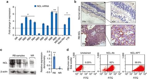Expression Of Nucleolin In Rb Tumor Samples And Cell Lines A Fold