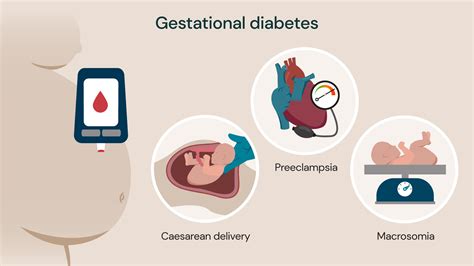 Diabetes Gestational