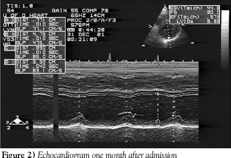 Figure 2 From Acute Reversible Left Ventricular Dysfunction Secondary