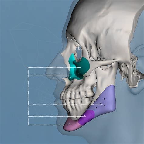 Asimetría Facial Causas Y Soluciones Dra Sandra Nieto