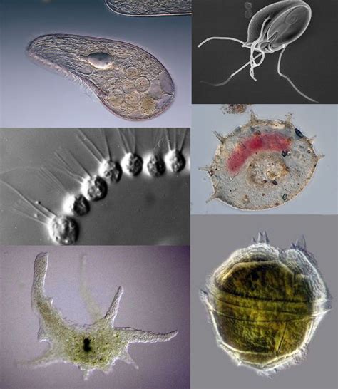 Parasitic Infections Physiopedia