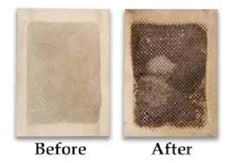 Kinohimitsu Footox Foot Patch 10s 10s Shopee Malaysia