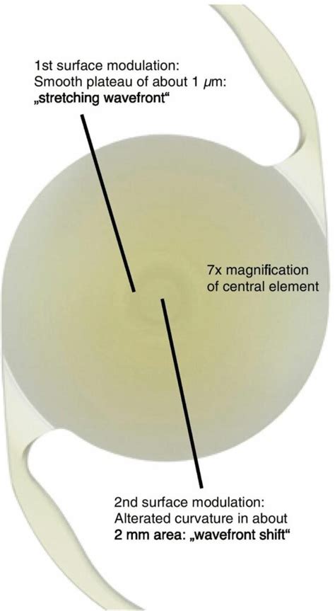Vivity Lenses How It Works Effectiveness Pros And Cons