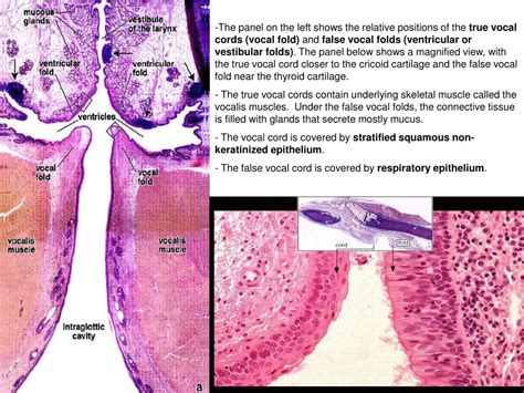 Ppt Respiratory Anatomy Histology Correlate Powerpoint Presentation