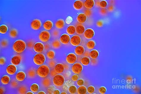 Haematococcus Sp 3 By Science Photo Library