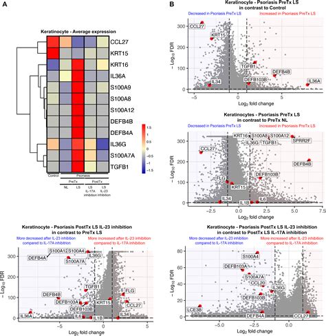 Psoriasis Harbors Multiple Pathogenic Type 17 T Cell Subsets Selective