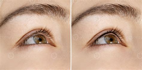 Comparison After Professional Permanent Makeup Treatment Lash Line