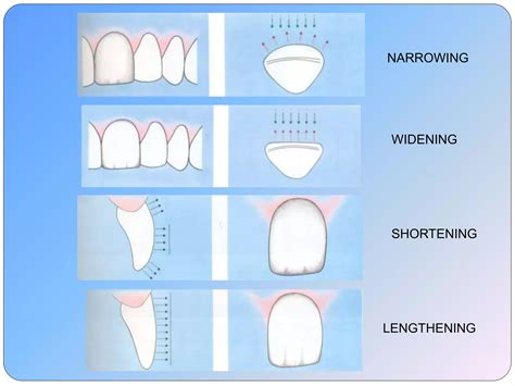 Esthetics In Fpd Pptx