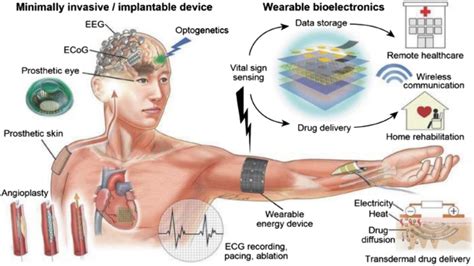 🩺💉 Medical Devices And Ivds Types Manufacturing Technologies And