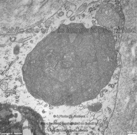 Heterolysosomes Dr Jastrows Electron Microscopic Atlas