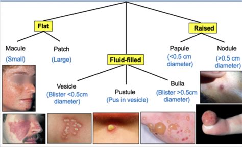 Y3 Dermatology Flashcards Quizlet