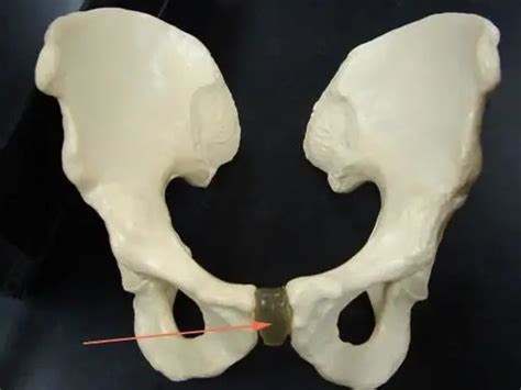 Pubic Symphysis Divergence Of The Pubic Symphysis During Pregnancy