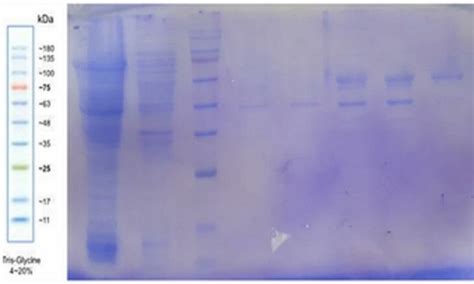 12 Sds Page Gel Showing The Different Steps Of Flic Protein
