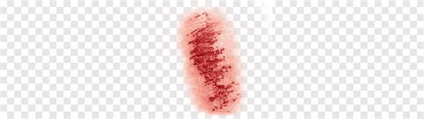 Human Skin Condition Light Wound People Wounds Png Pngegg