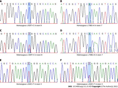 Three Novel Homozygous Itgb2 Mutations Among Two Patients With