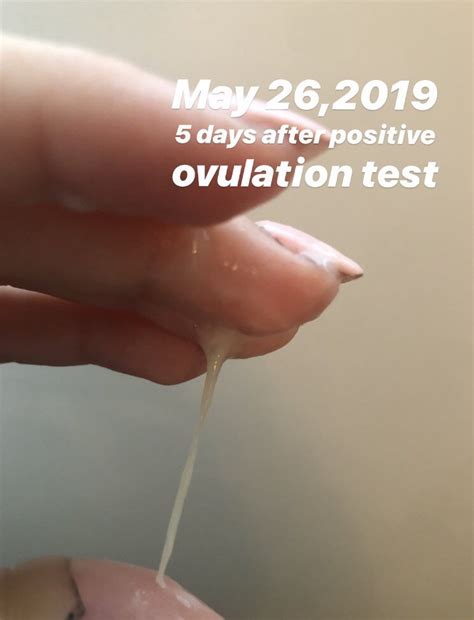 After Ovulation Discharge
