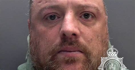 Broken Eye Socket Bone Had To Be Popped Back In After Man Punched Partners Face North Wales