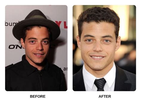 Denzel Washington Teeth Before And After What Happened In His Transformation Dental