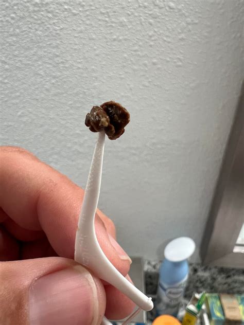Bought An Earwax Removal Machine This Is My Good Ear R Earwax