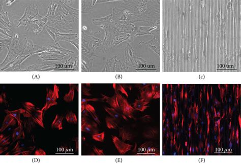 The Cell Morphology Of Tspcs On Different Matrix Surfaces A Cell Download Scientific Diagram