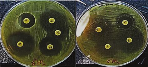 The Susceptibility Spectrum Of Strain 6hl Enterococcus Durans