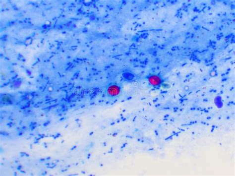 Cryptosporidium Parvum Microscope