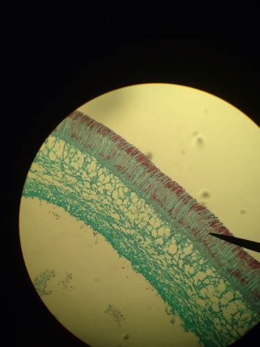 Fungi Flashcards Quizlet