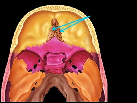 Olfactory Foramina Location Middle Cranial Fossa Boundaries