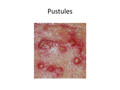 Ppt Macules Powerpoint Presentation Free Download Id2264306