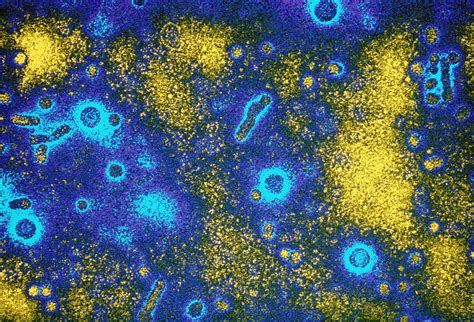 Así Se Ven El Virus Nipah El Vih Y Otros Bajo El Microscopio