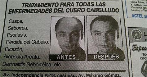 I Guess Sheldon Used To Be Bald R Pics