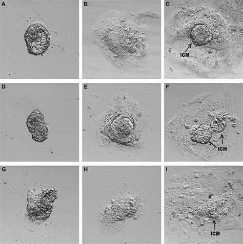 Hoffman Modulation Contrast Photomicrographs Of Blastocyst Attachment Download Scientific