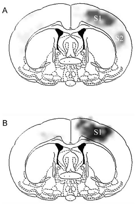 Figure 1 From Neurophysiology Of Functional Imaging Semantic Scholar