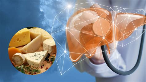 Премногу сирење Рецепт за замастен црн дроб Д р Митов