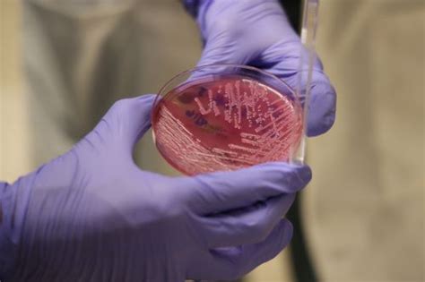 Microbiology Mcgovern Medical School