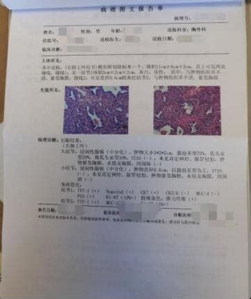 2分钟教会你看自己的病理报告！ 知乎