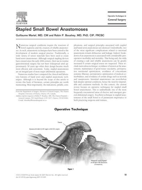 What Checks Ileocolic Anastomosis Procedure