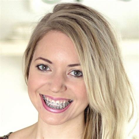 Braces And Glasses Adult Braces Cute Braces Orthodontic Appliances Woman Face Teen Girl