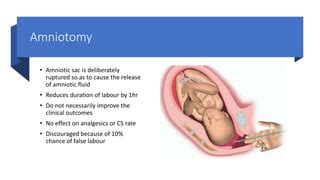 The First Stage Of Labour Poor Progression Of Labour And Augmentation