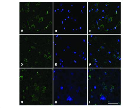 Hemoglobin Alpha Chain In The Frontal Cortex Of Control Subject