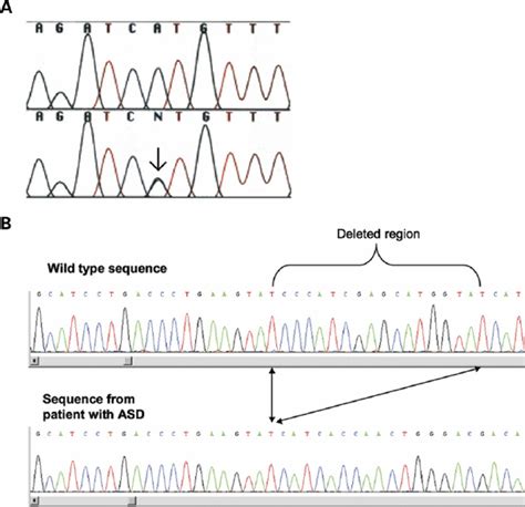 Two Different Cardiac Alpha Actin Mutations Found In Individuals Download Scientific Diagram