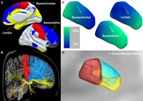 The Distal Atlas Lead Dbs