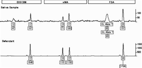 Ambiguous Dna Evidence The Electropherogram Of The Crime Scene