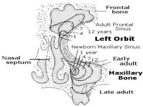 Surgical Anatomy Of Maxillary Sinus Lateral Wall Of Nose And Soft