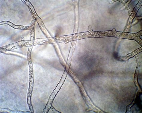Fungi Hyphae Medical Laboratories