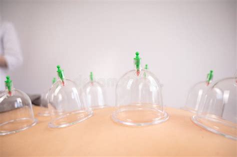 Female Massage Therapist Uses Vacuum Cans On The Patient S Back Stock Image Image Of Wellness