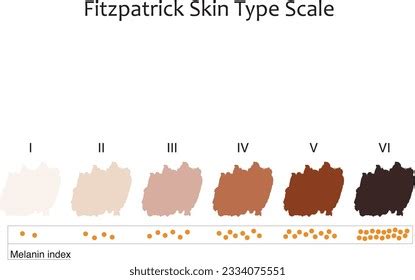 Fitzpatrick Scale Over 29 093 Royalty Free Licensable Stock